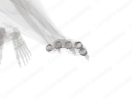 Metacarpophalangeal Joint - an overview | ScienceDirect Topics