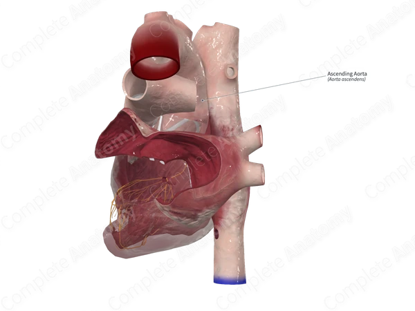 Ektatische Aorta Ascendens