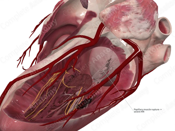 Chordae Tendineae Describe The Function Of The Chordae Tendineae And