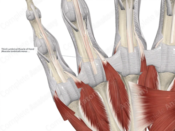 Lumbrical Lumbrical Muscles Of The Hand | Radiology Reference Article