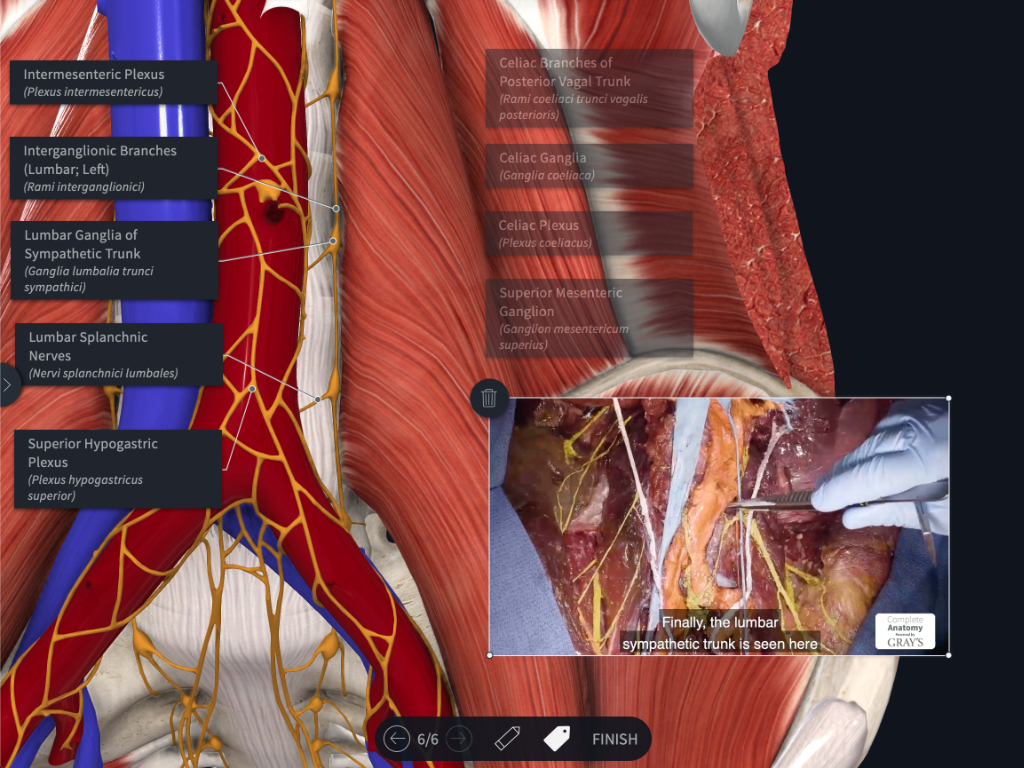 Guided Dissection: The Abdomen