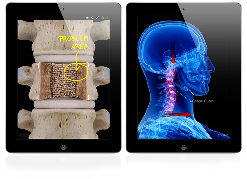 Orthopedic Patient Education